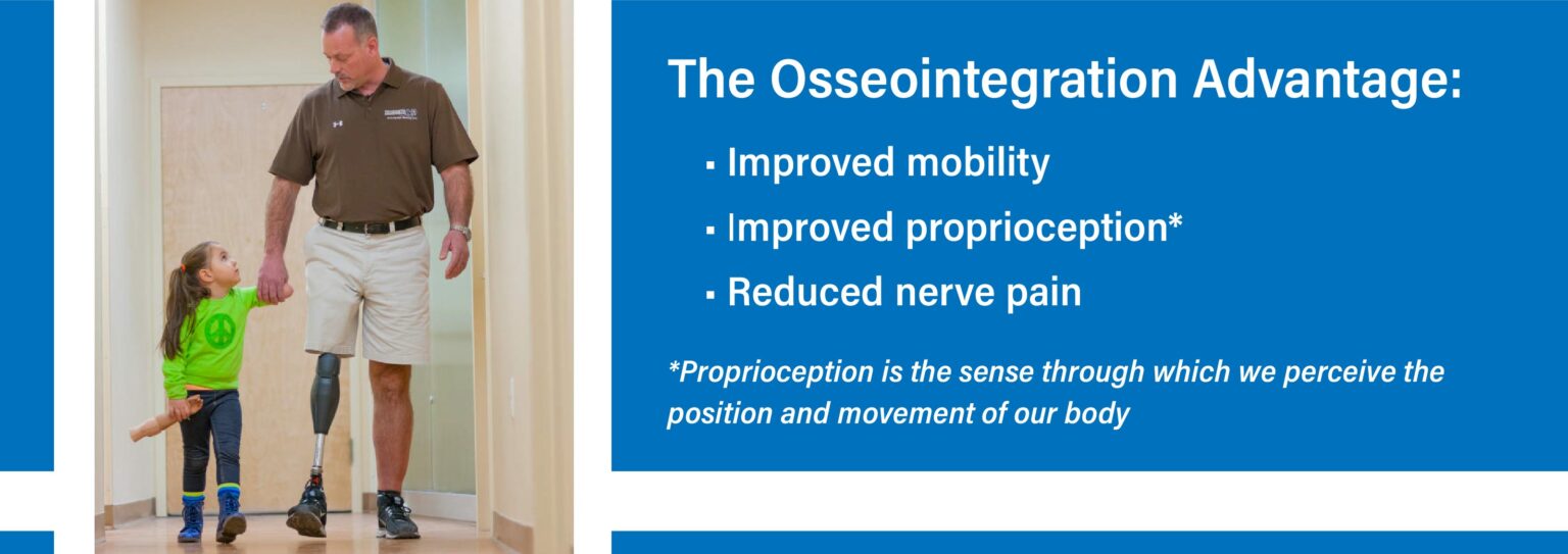 Osseointegration Limb Replacement Center – Limb Lengthening